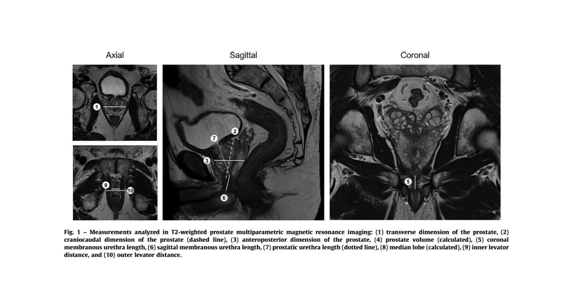 Preoperative prostate magnetic resonance imaging-based anatomical ...